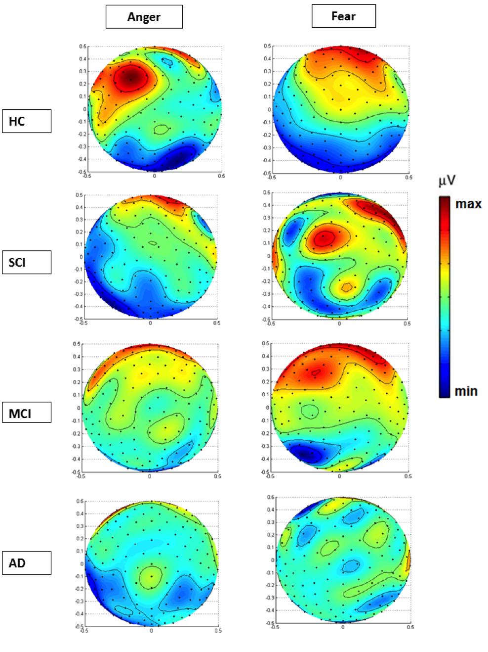 Excited To Announce That Our Paper On Using Eeg As A Biomarker For